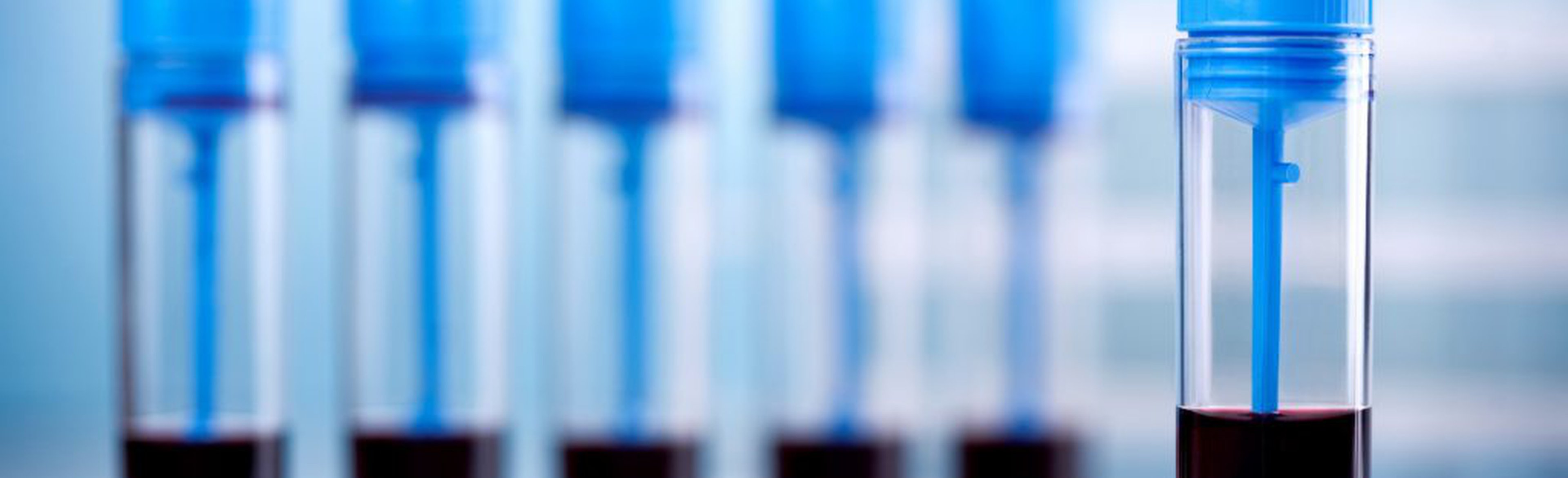 Does POCT offer patients a better way forward? | Hart Bio