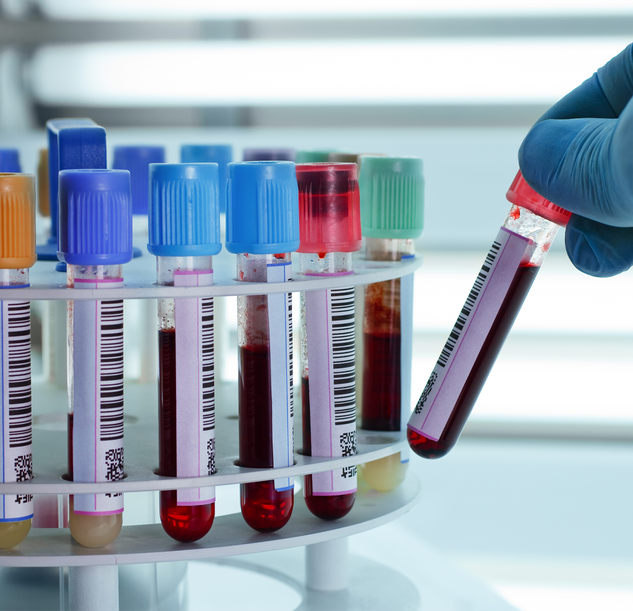 Platelet Aggregation | Hart Biological
